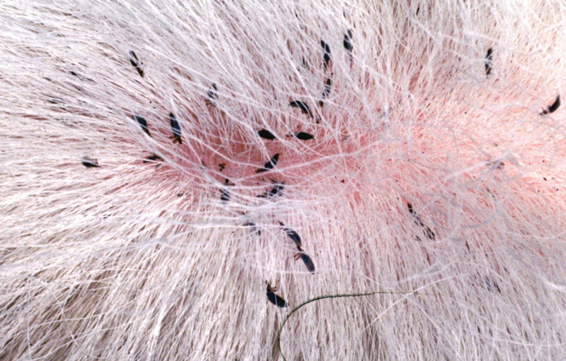 Cómo son los piojos - 14 pasos - Salud Doncomos.com