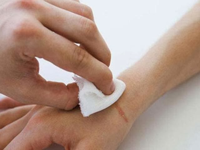 Cómo curar heridas - 3 pasos - Salud Doncomos.com